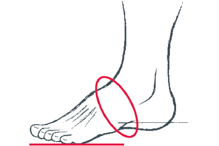 VASYLI + Hoke — Vasyli Medical