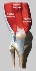 Ilio Tibial Band Syndrome — Vasyli Medical