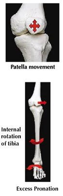 Patello Femoral Syndrome — Vasyli Medical