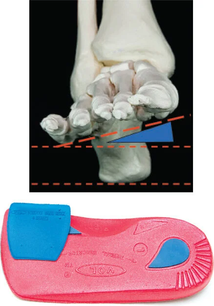 Orthotic Additions — Vasyli Medical
