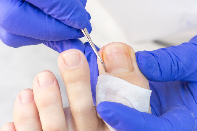 Birmingham Podiatry & Chiropody Clinic | Walsh Podiatry
