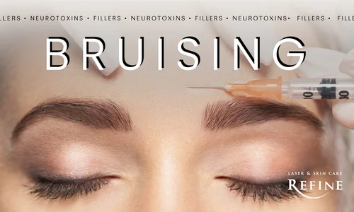 Reduce Bruising from Fillers and Botox | Chaska | Refine — Refine Laser ...