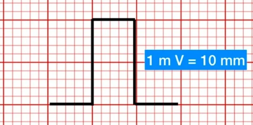 ECG 101: The ECG Paper Explained — The PR Segment.com