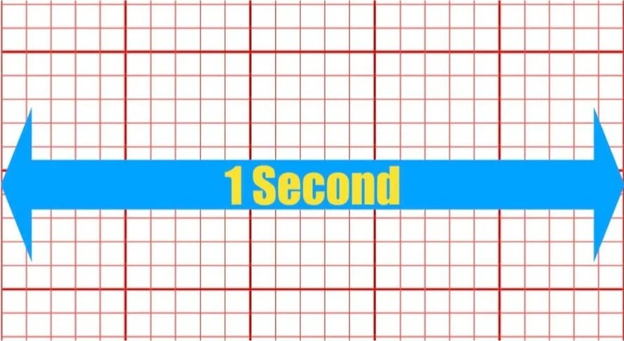 ECG 101: The ECG Paper Explained — The PR Segment.com