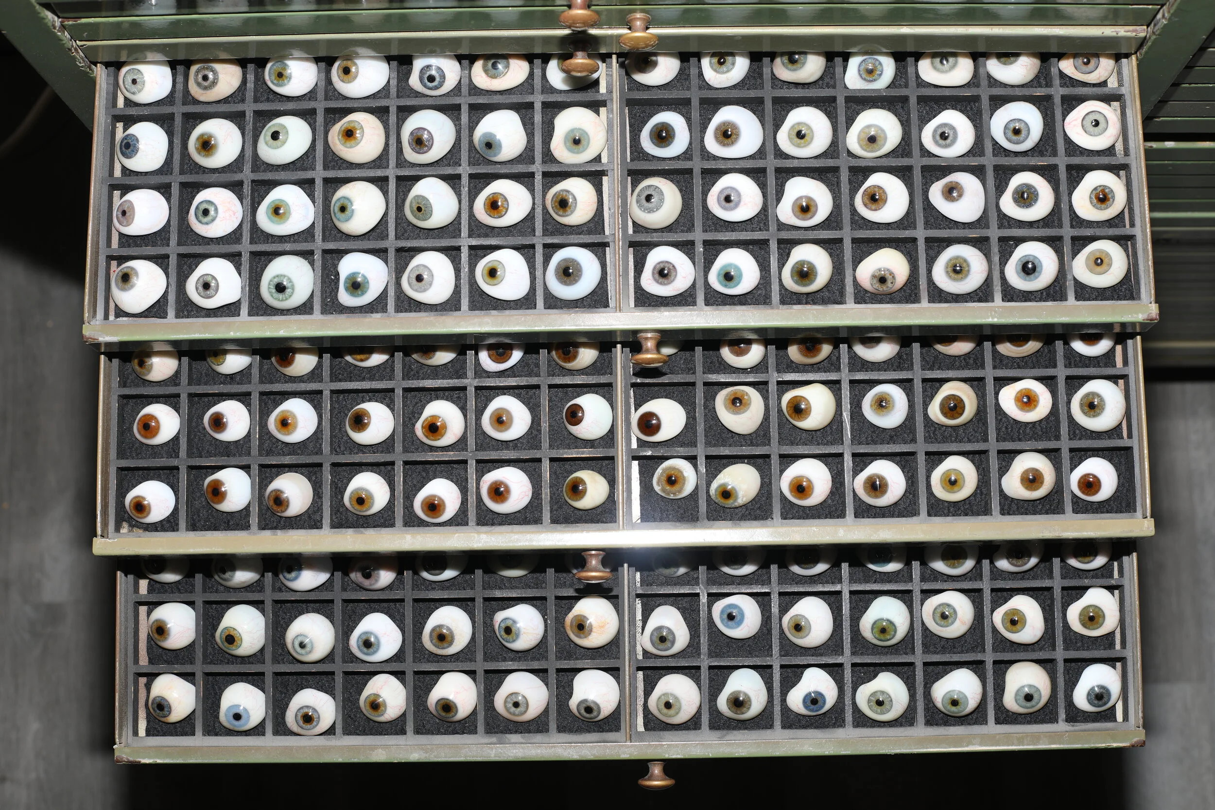 Impression Fitted Ocular Prosthesis New York | Mager & Gougelman