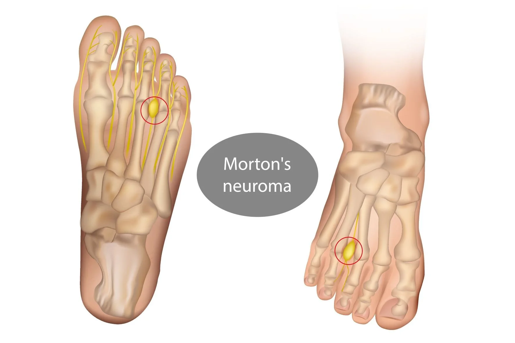7 Reasons Why You Might Have Foot Pain — Dr. Elton