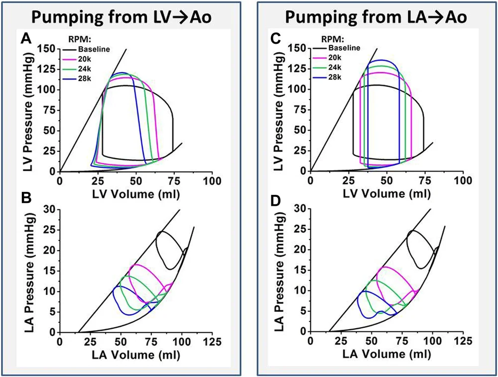 Stats + Facts — Cardiost - LAUD or Left Atrium Unloading Device