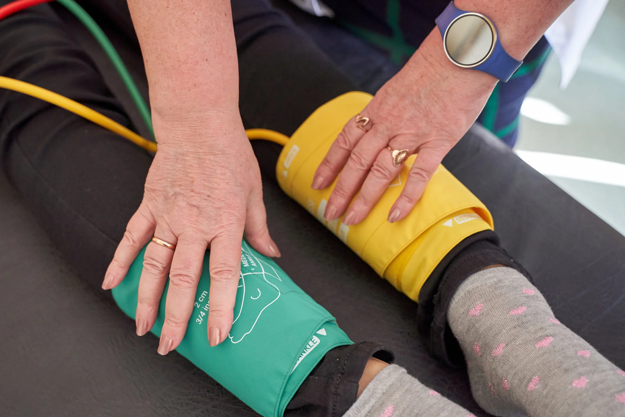 Peripheral Arterial Disease (PAD) Screening & Treatments in Orange ...