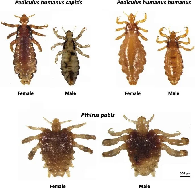 Empat ektoparasit yang umum menginfestasi manusia dan menyebabkan ...