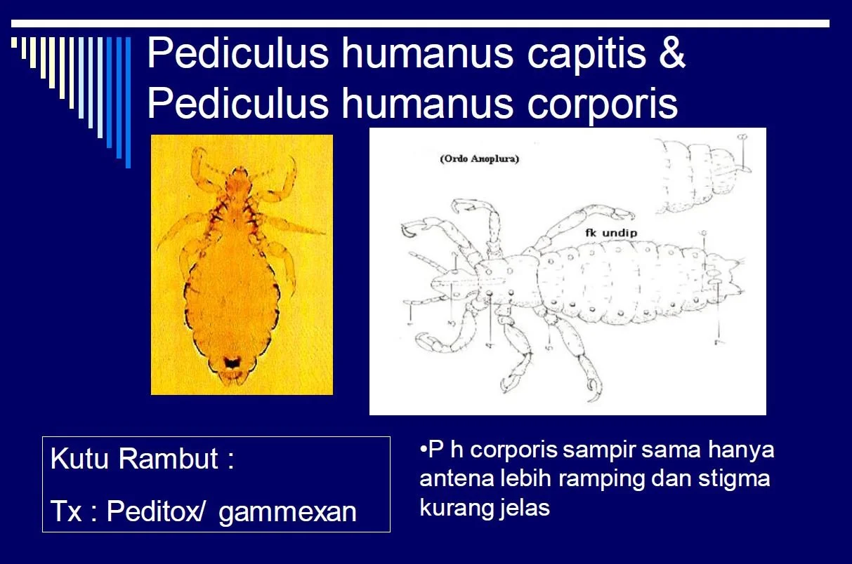 Empat ektoparasit yang umum menginfestasi manusia dan menyebabkan ...