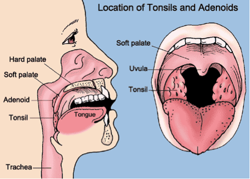 Tonsils And Adenoids