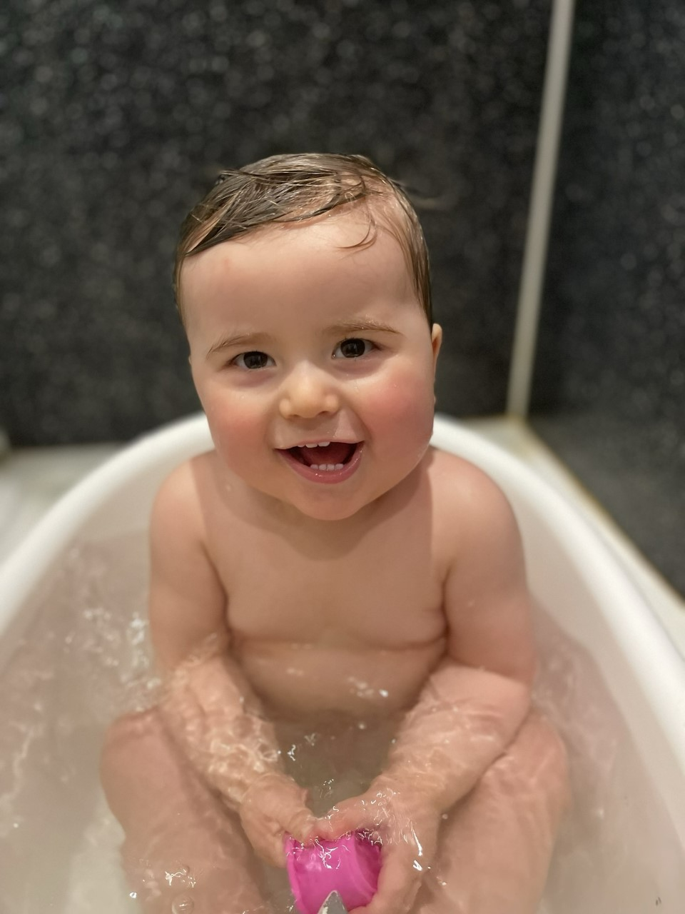 Helmet therapy Client Stories — Access Orthotics