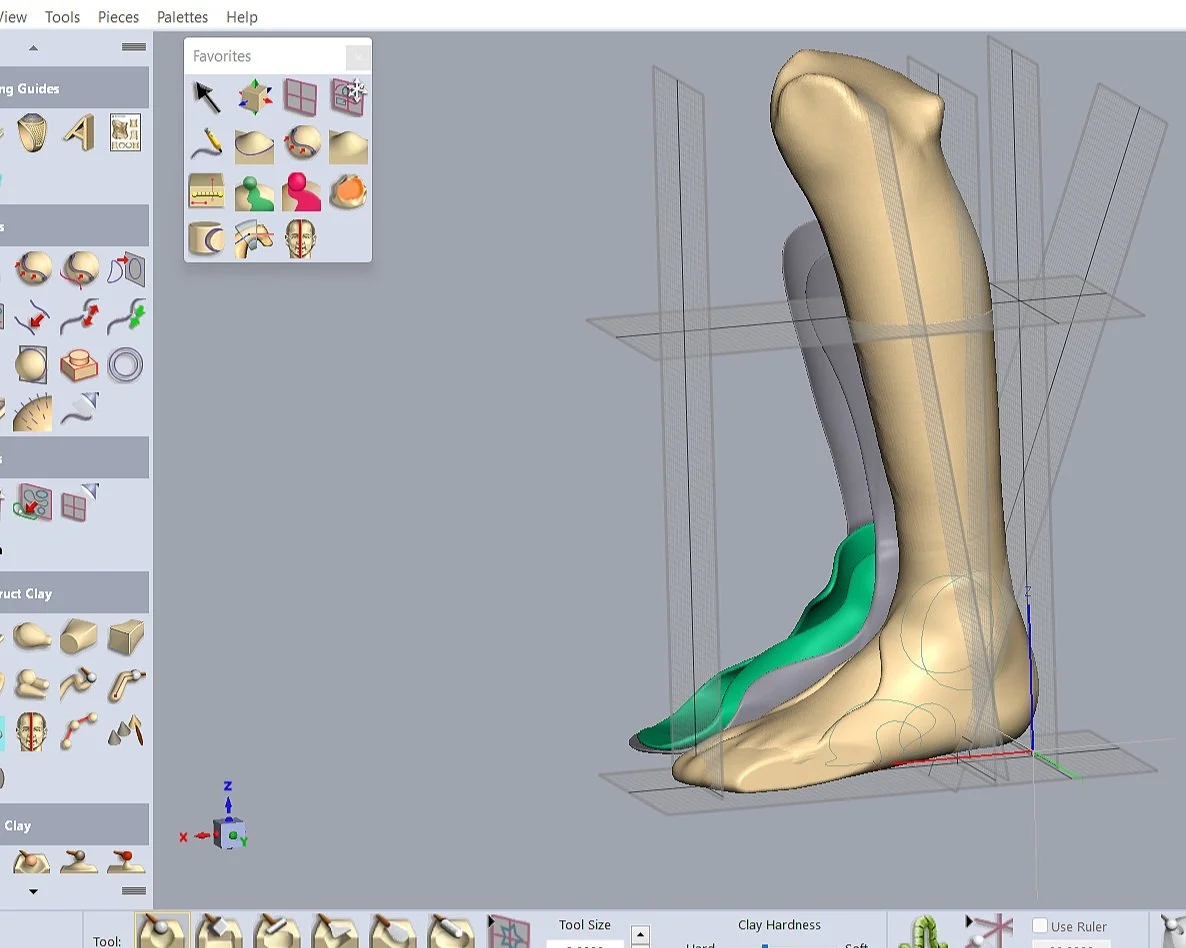 Appointment Types — Access Orthotics