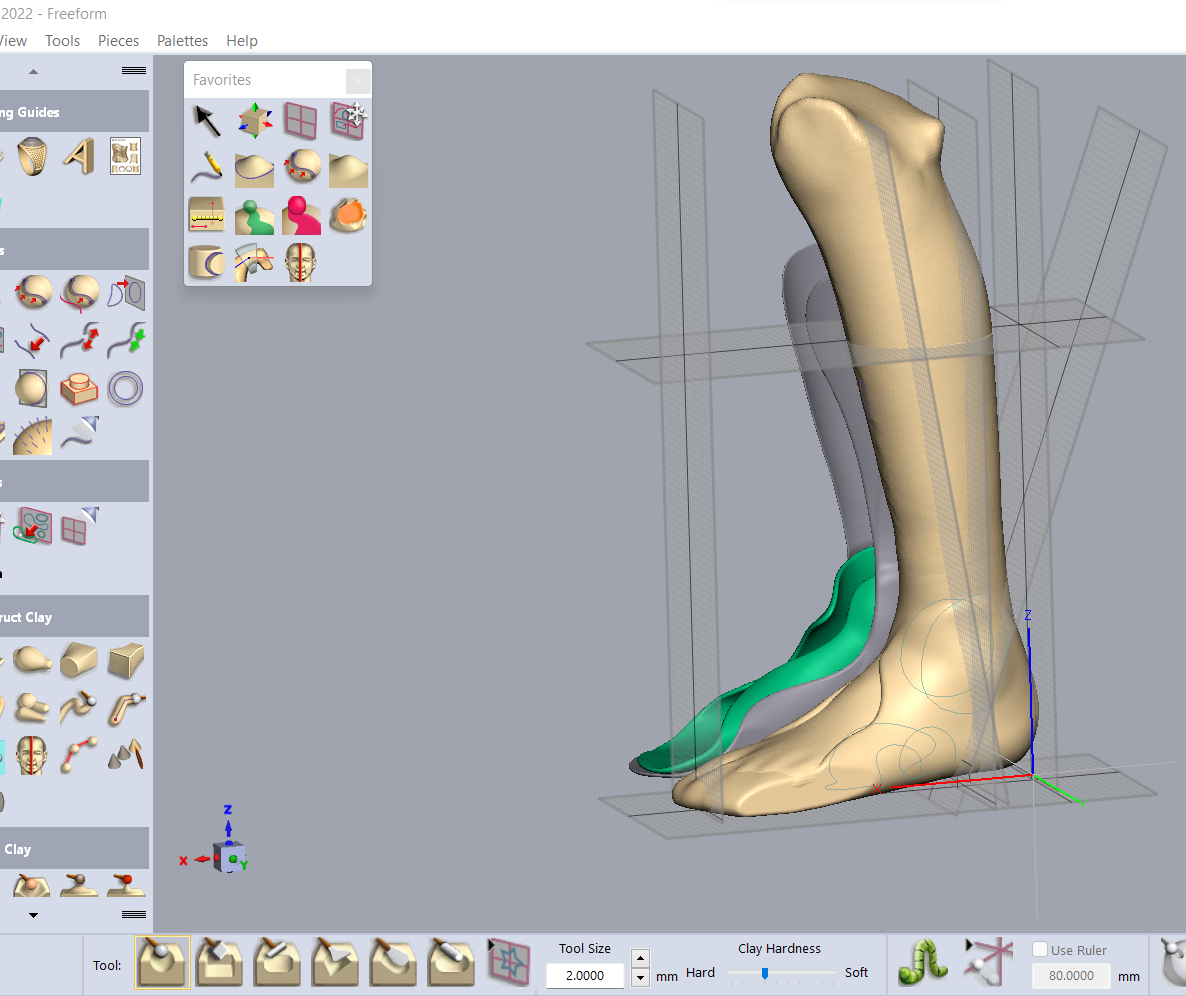 Custom Made Orthoses — Access Orthotics