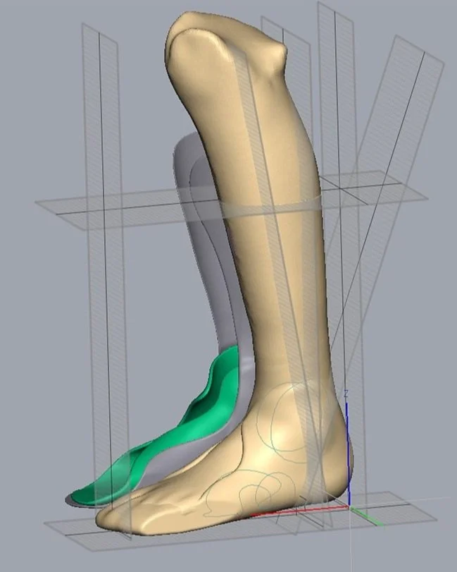 Fabrication — Access Orthotics