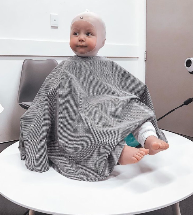 Helmet Therapy — Access Orthotics