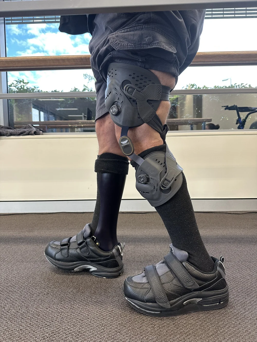 Custom Made Orthoses — Access Orthotics