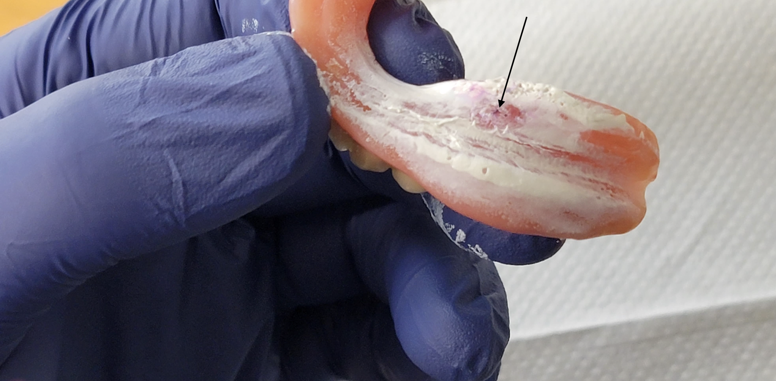 Hydent® Sticks Denture High Spot Sticks — Pascal