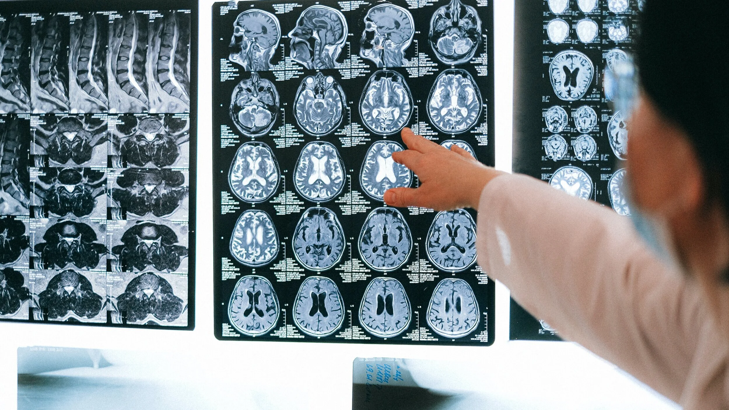 How Does Trauma Affect the Brain? - And what it means for you