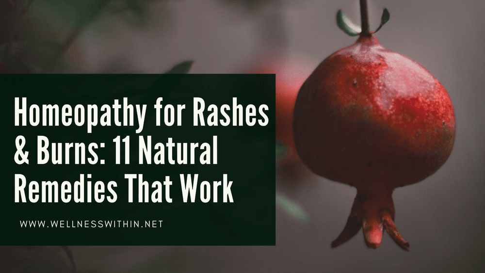 Homeopathy for Rashes & Burns: 11 Natural Remedies That Work — WELLNESS ...