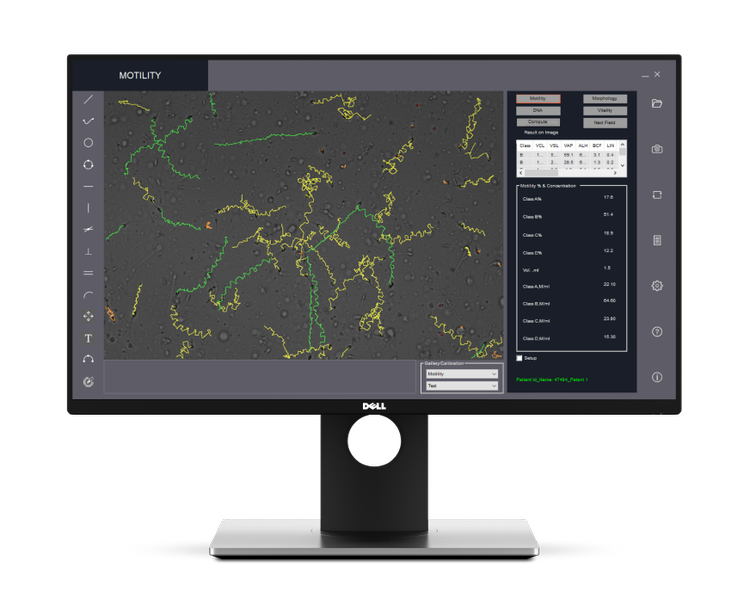 Microscope | Software | Dewinter