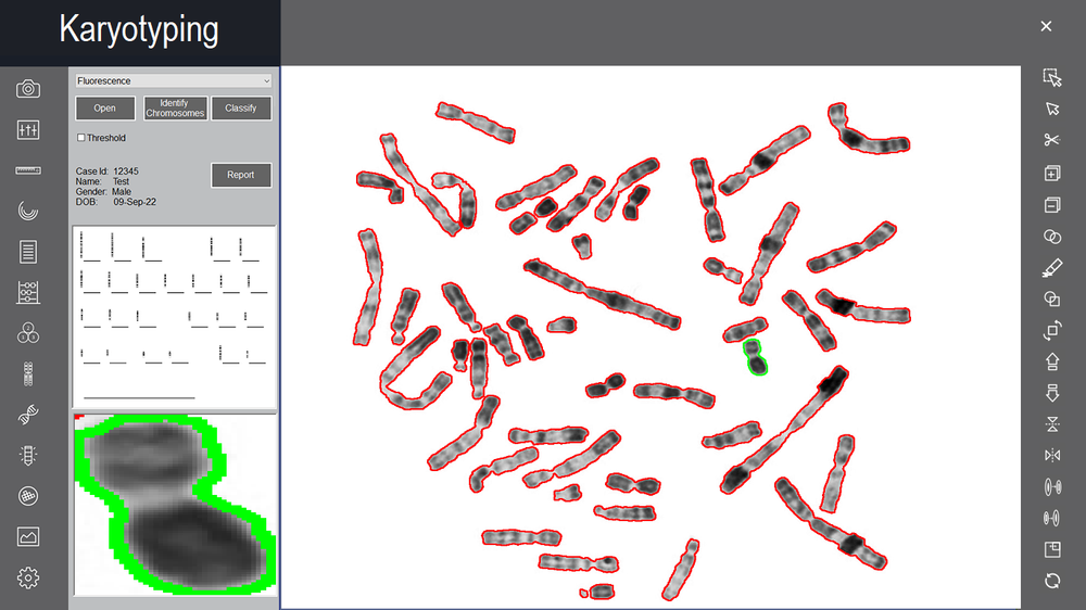 KaryoPlus - Karyotyping & Fish Analysis Software | Enhance Your ...