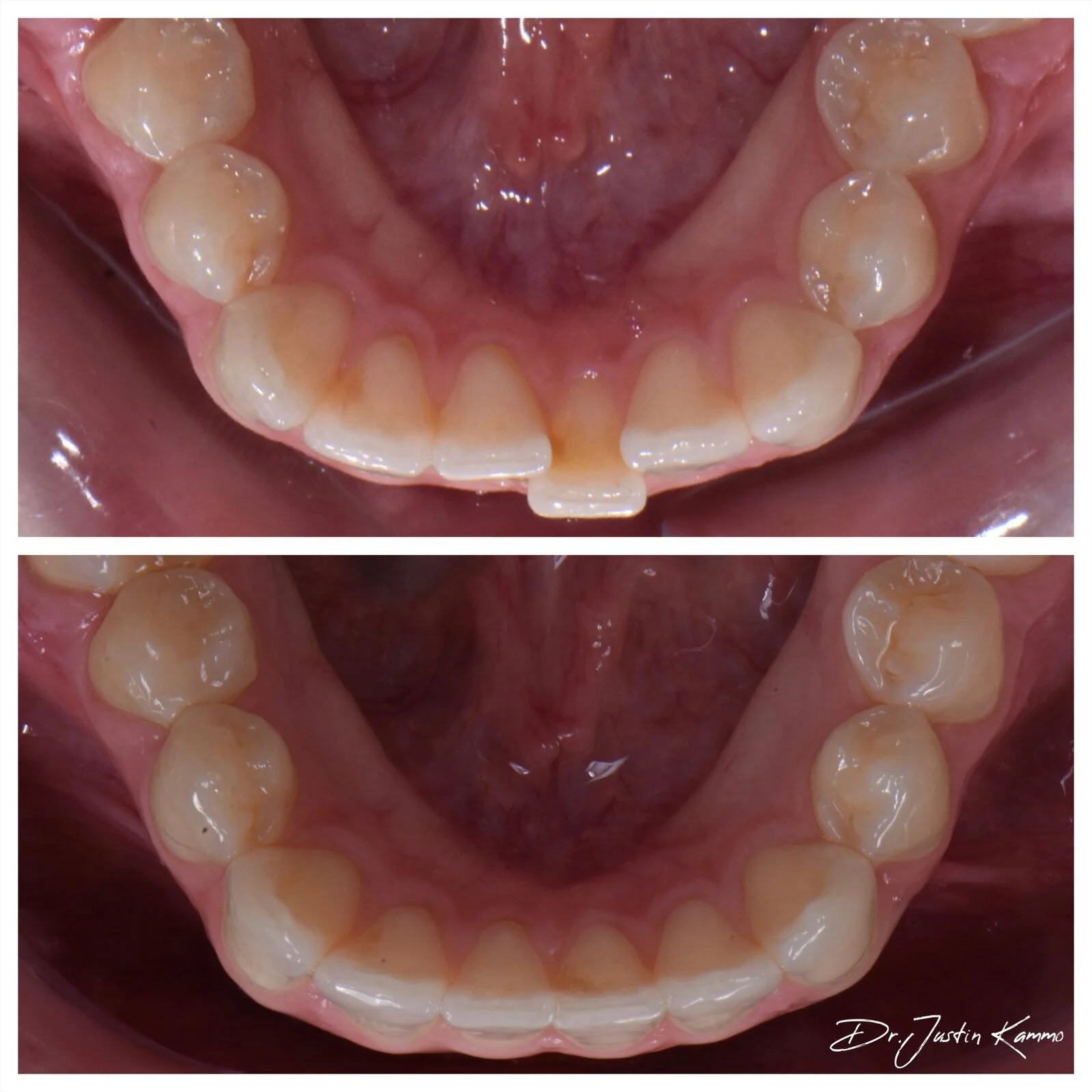 Profound Orthodontics