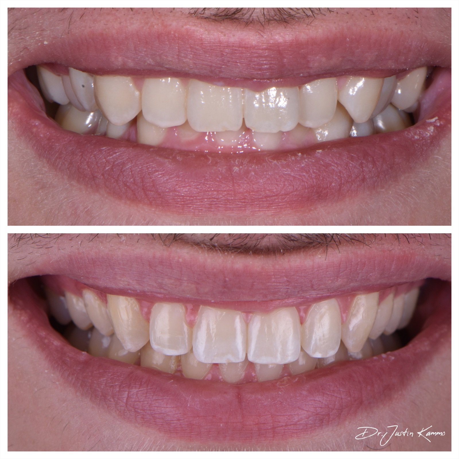 Profound Orthodontics