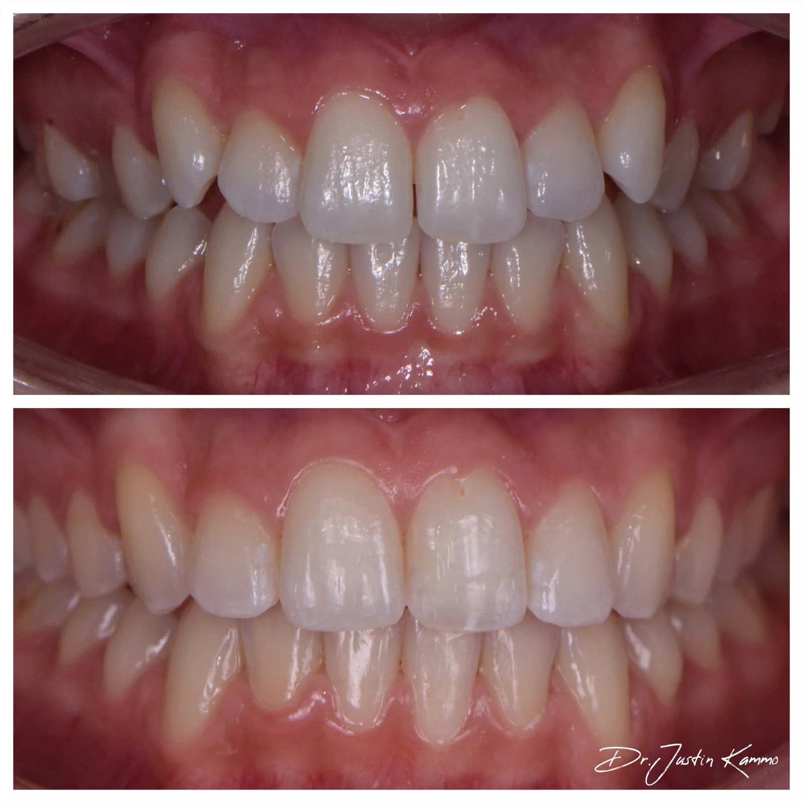 Profound Orthodontics