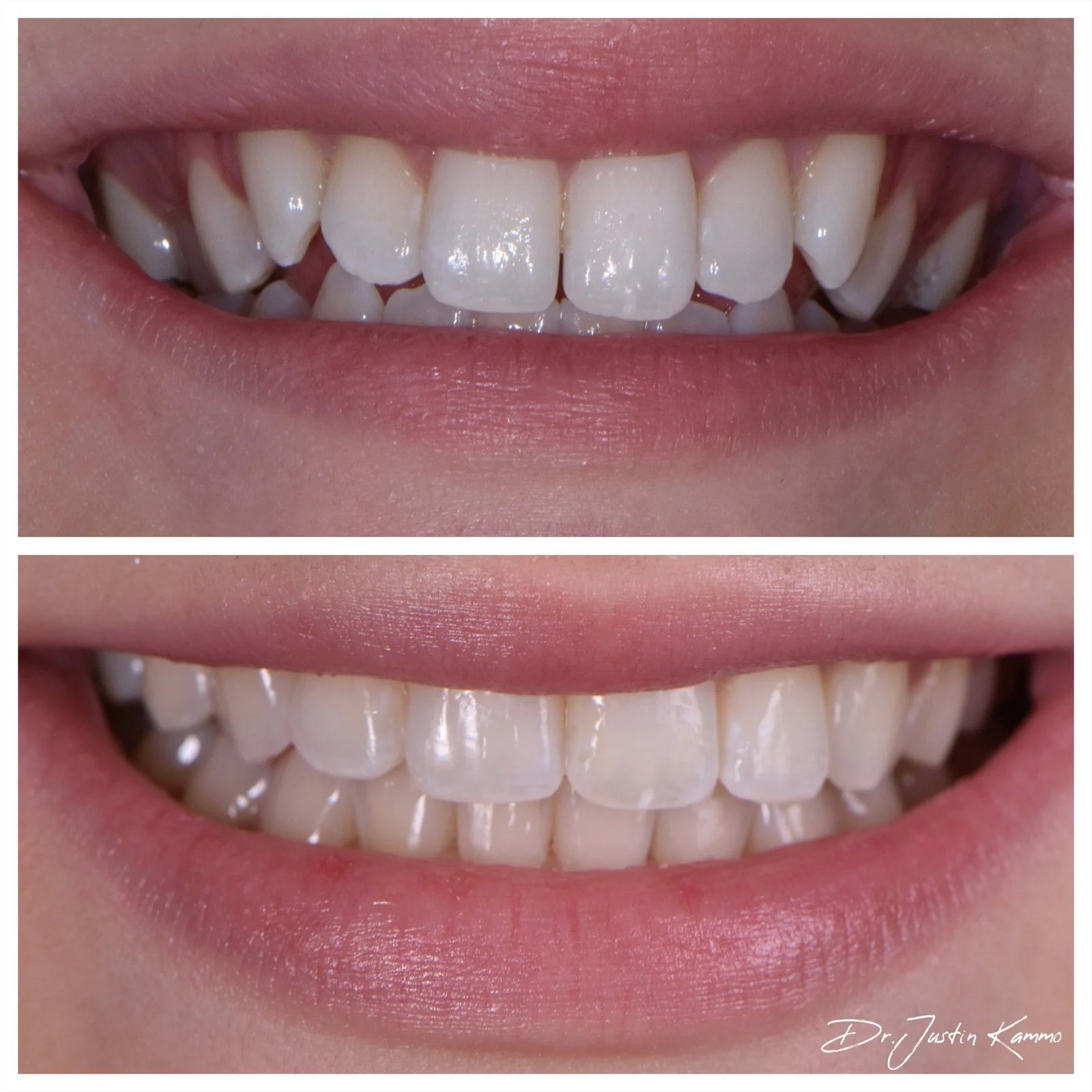 Profound Orthodontics