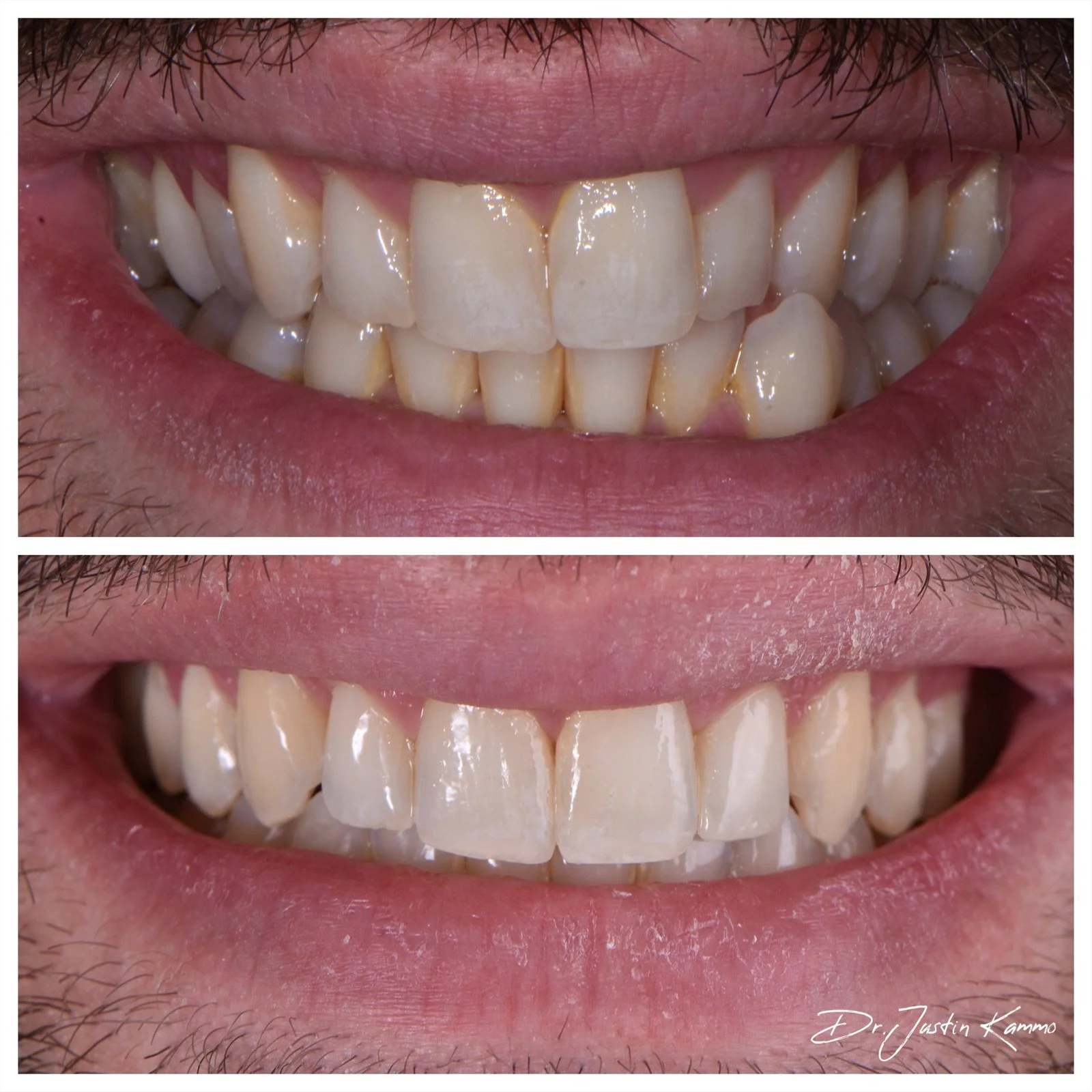 Profound Orthodontics