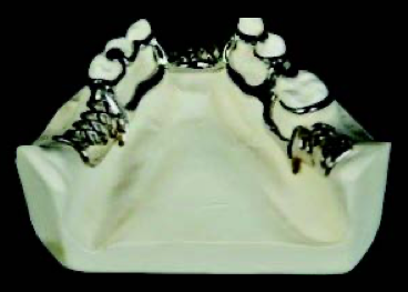 Removables — Pow Laboratories