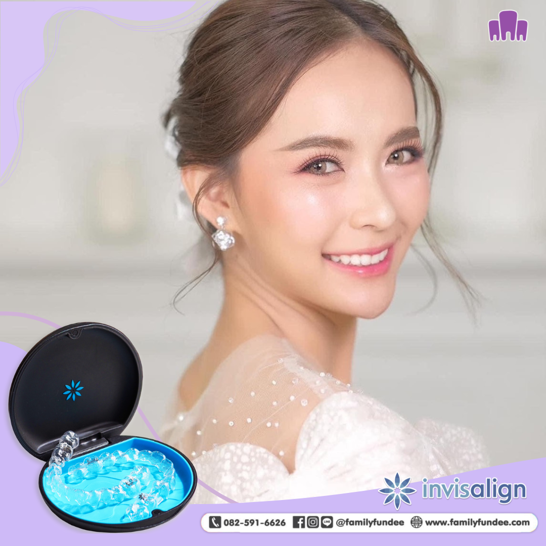 รีวิวInvisalign — Family Dental Clinic