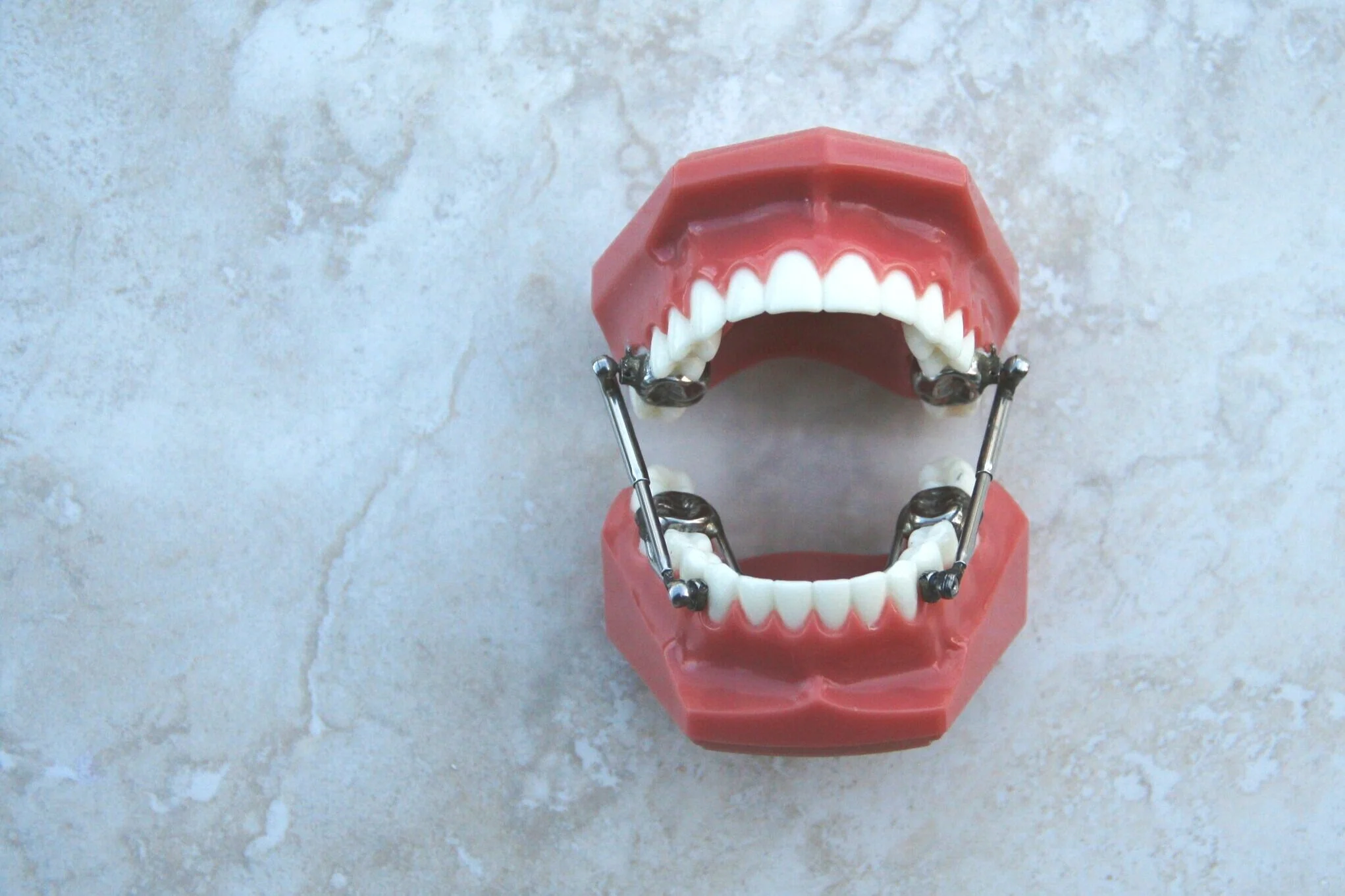 Appliances — APO Orthodontic and Dental Lab