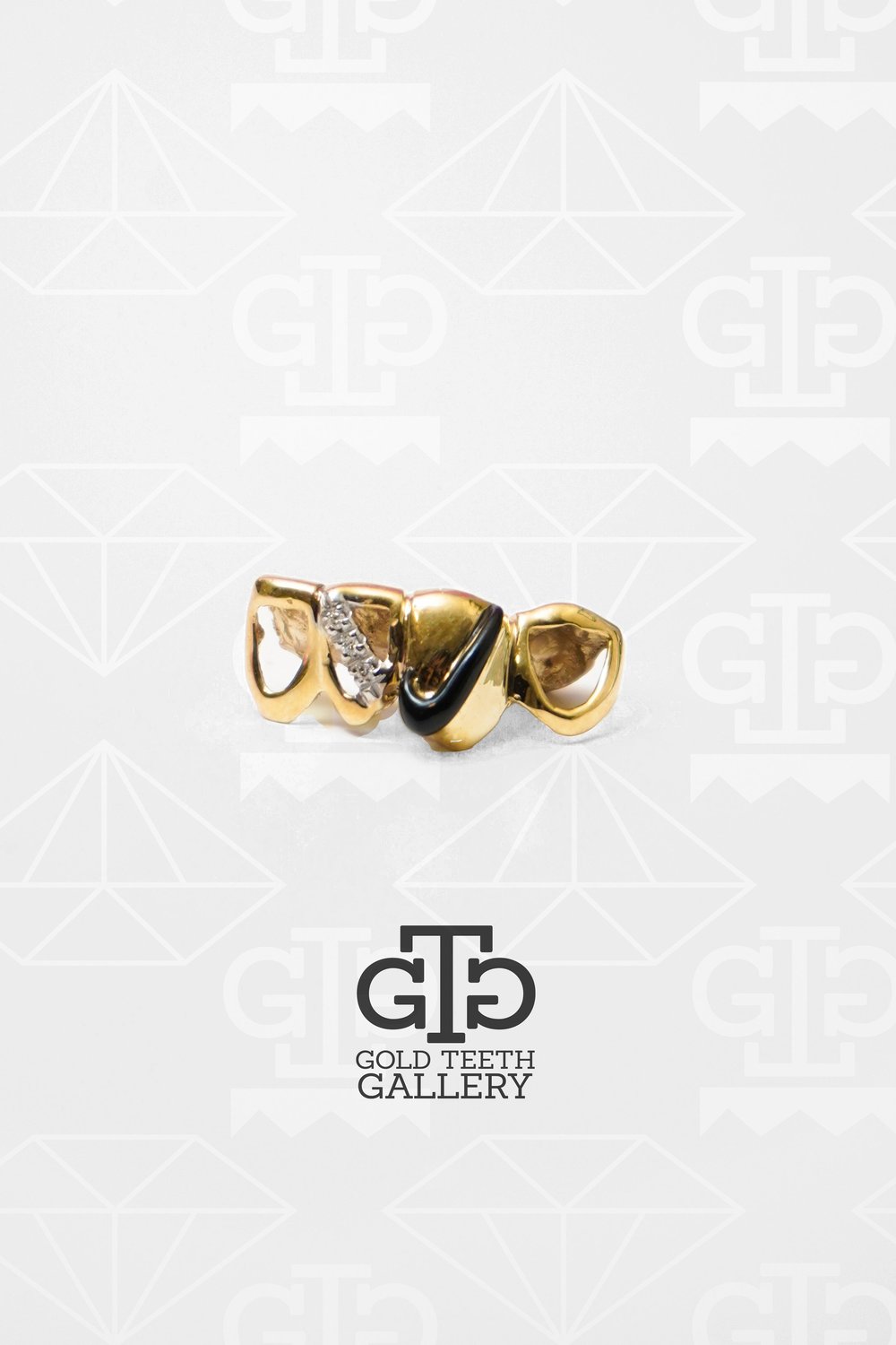 Gold Teeth Gallery