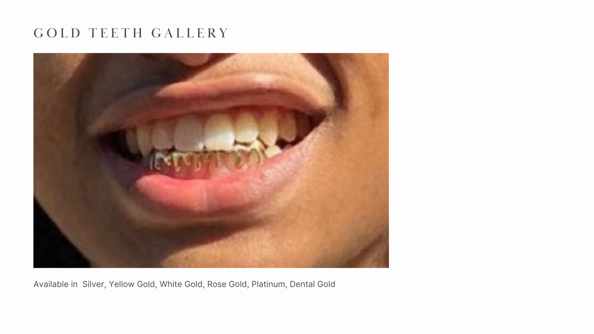 Gold Teeth Gallery