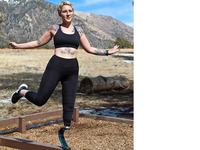 About us | Next Step Prosthetics