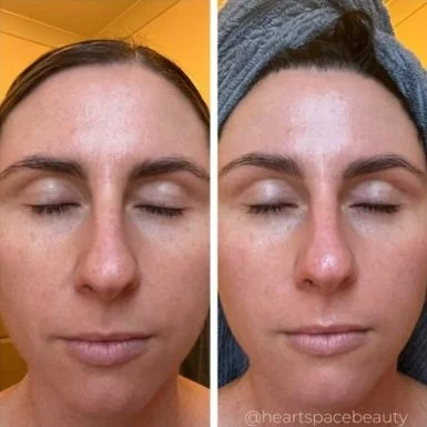 Enzyme Therapy Facial | Detoxify Your Skin | Heart Space Beauty