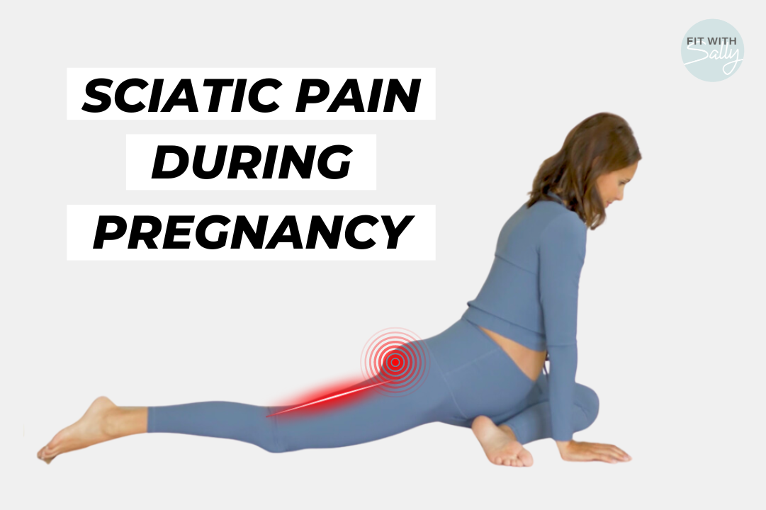 Sciatic nerve pain: Pregnancy & Postpartum — Fit With Sally
