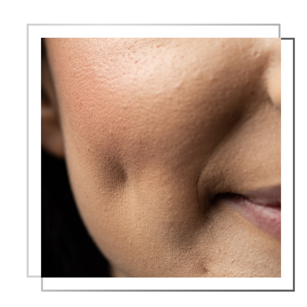 Face Procedures — Virginia Plastic Surgery | Where You Are The VIP