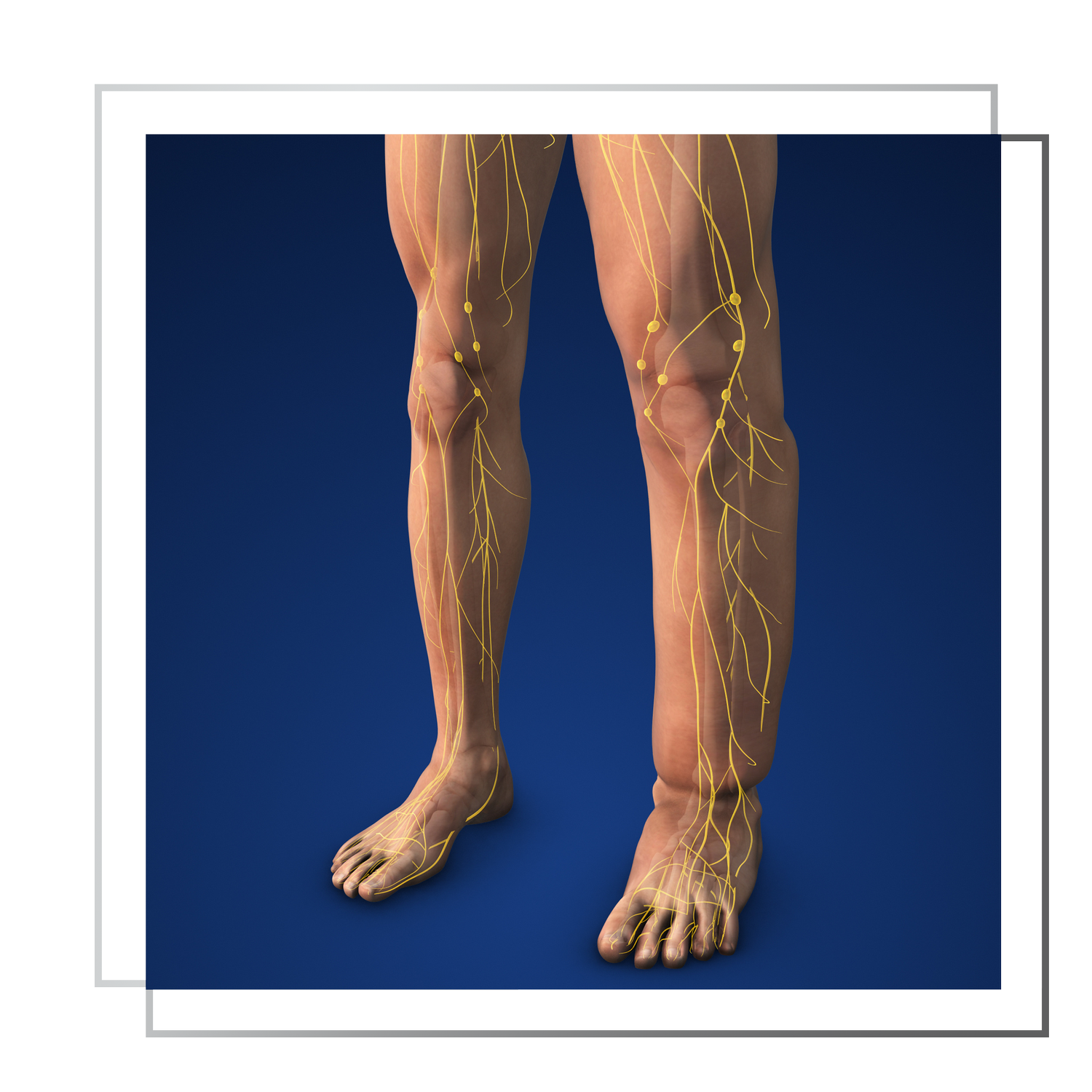 Lymphedema — Virginia Plastic Surgery | Where You Are The VIP