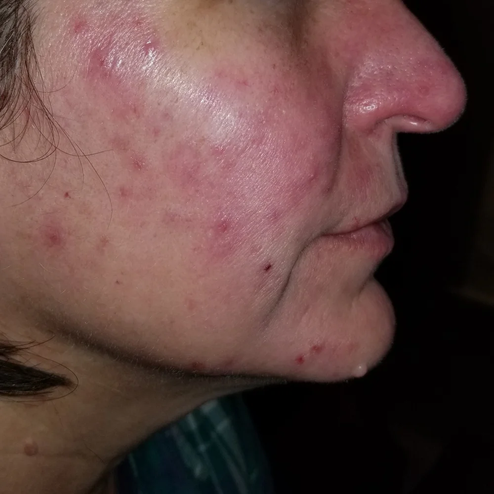 Solution RO: Stabilize Stasis Heat Herbal Supplement — CMD Skin Solutions