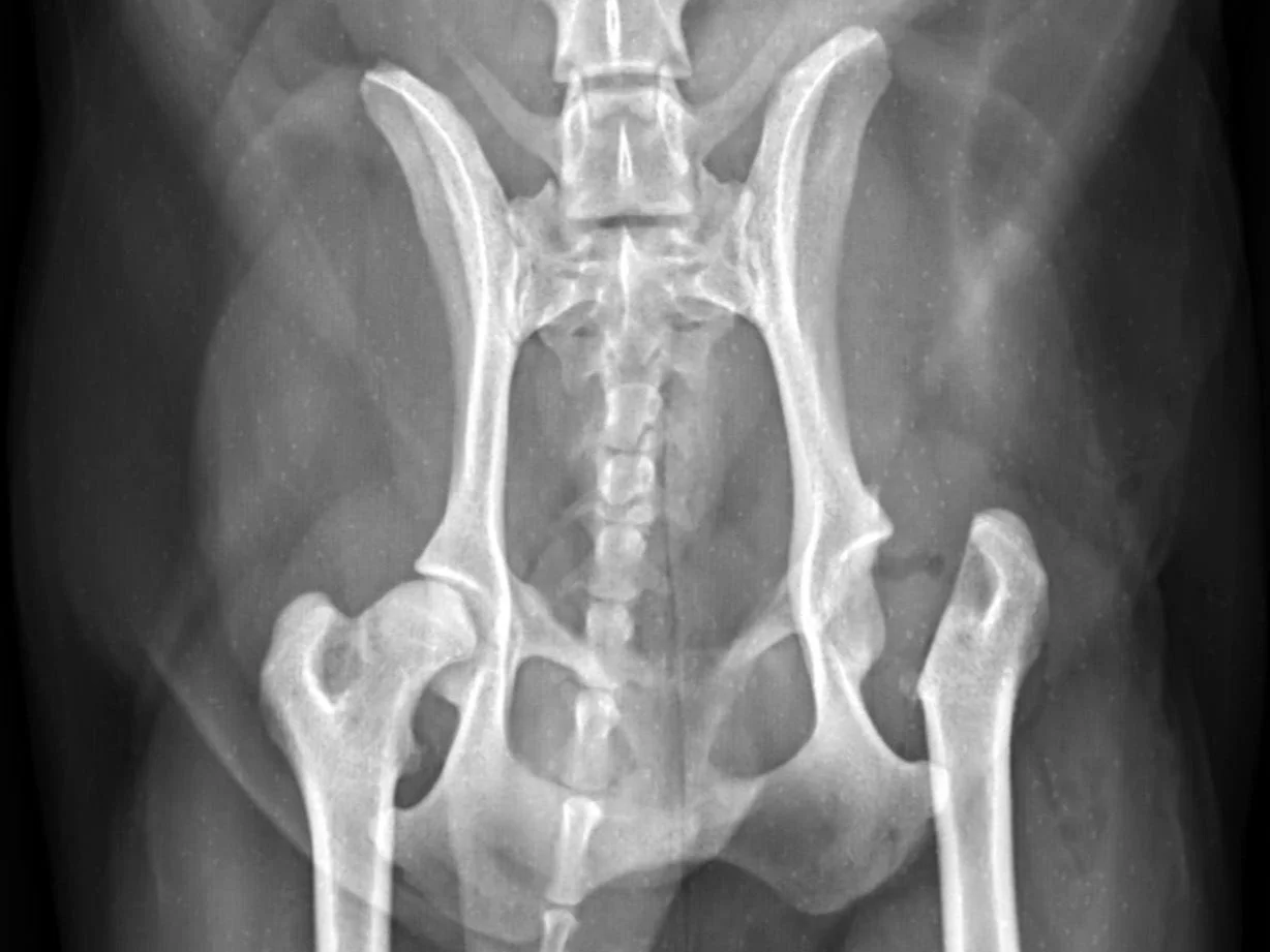 Falls & Fractures