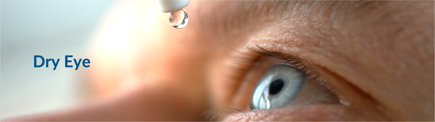 Dry Eye Symptoms & Treatments in Detroit | Shanbom Eye Specialist