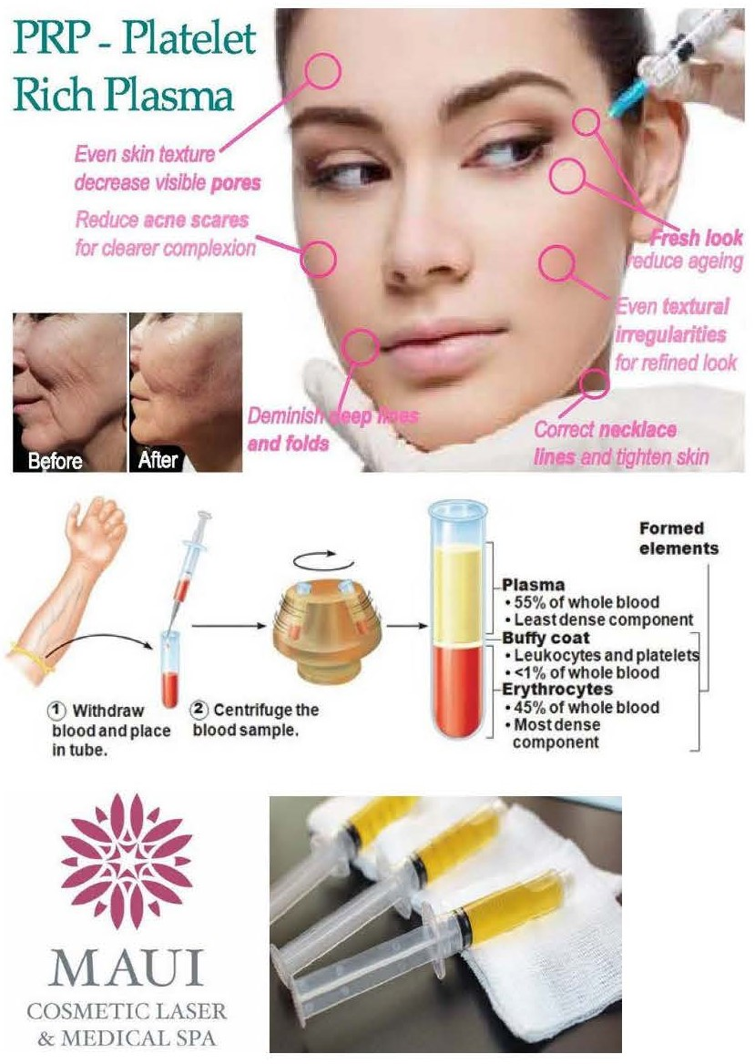 PRP — Maui Cosmetic Laser & Medical Spa