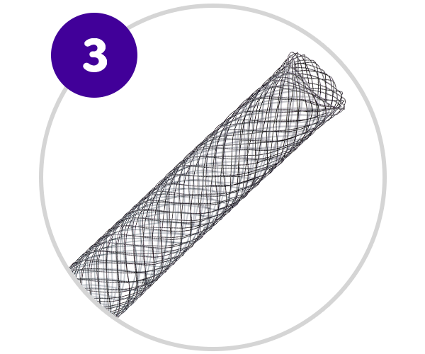 Product — Pounce™ Thrombectomy System