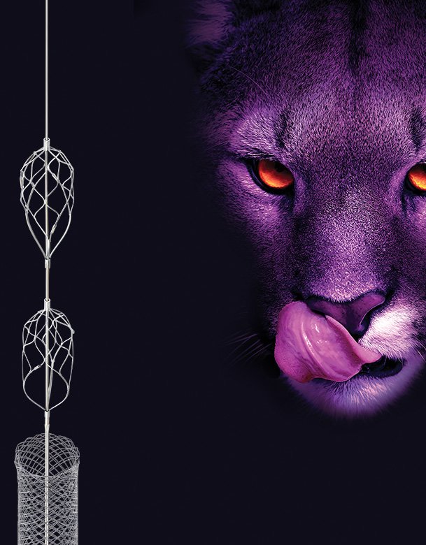 Pounce™ Thrombectomy System