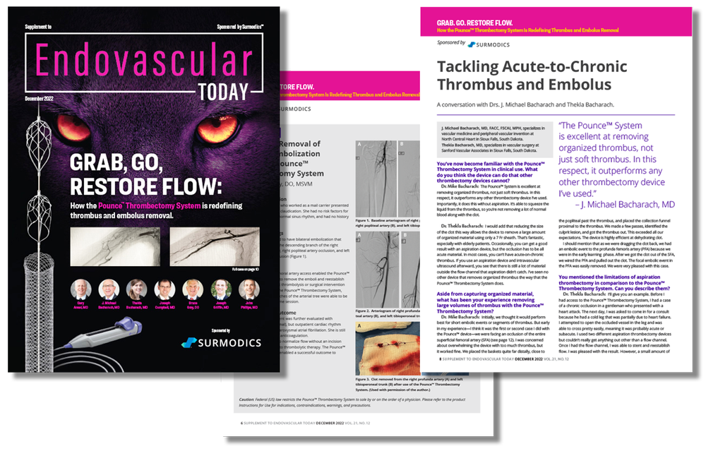Pounce™ Thrombectomy System