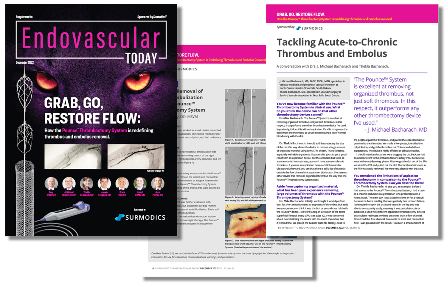 Pounce™ Thrombectomy System