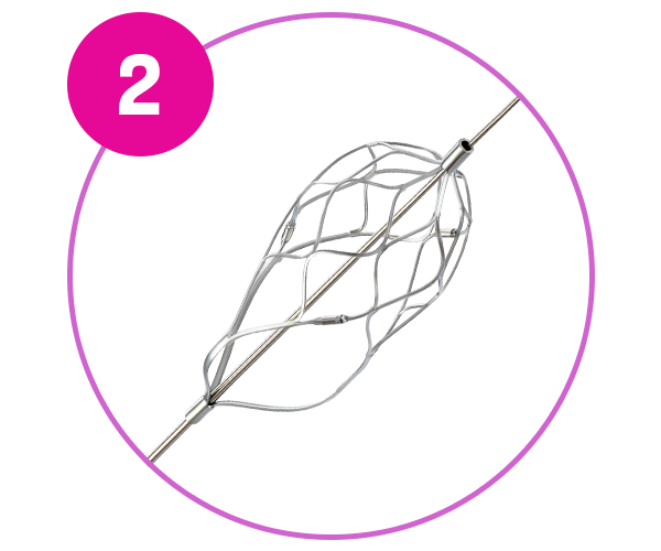 Product — Pounce™ Thrombectomy System